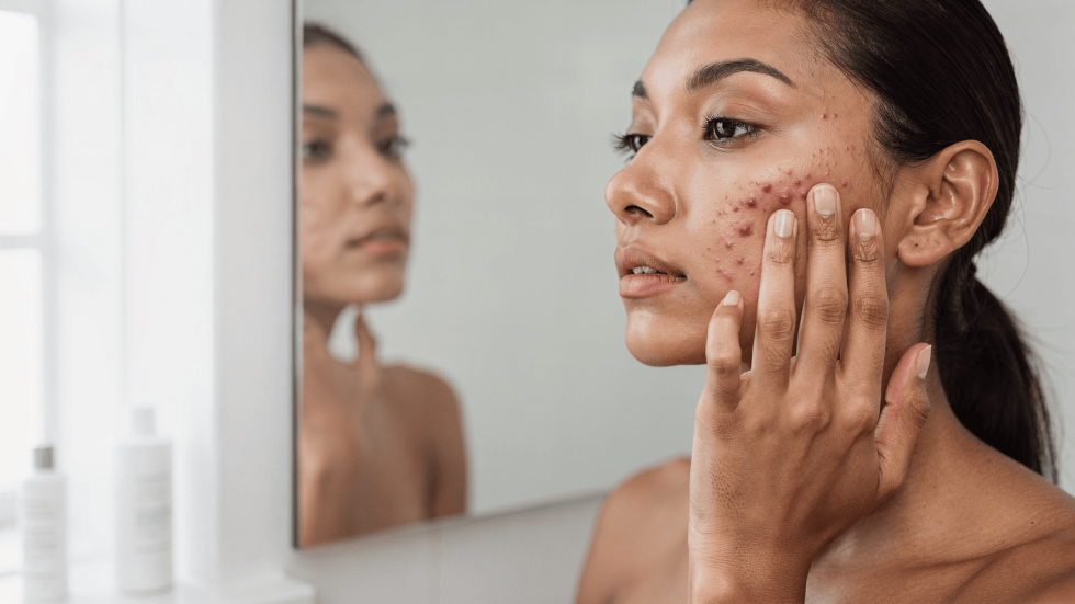 Iron Supplements: Can Iron Overload Cause Acne?